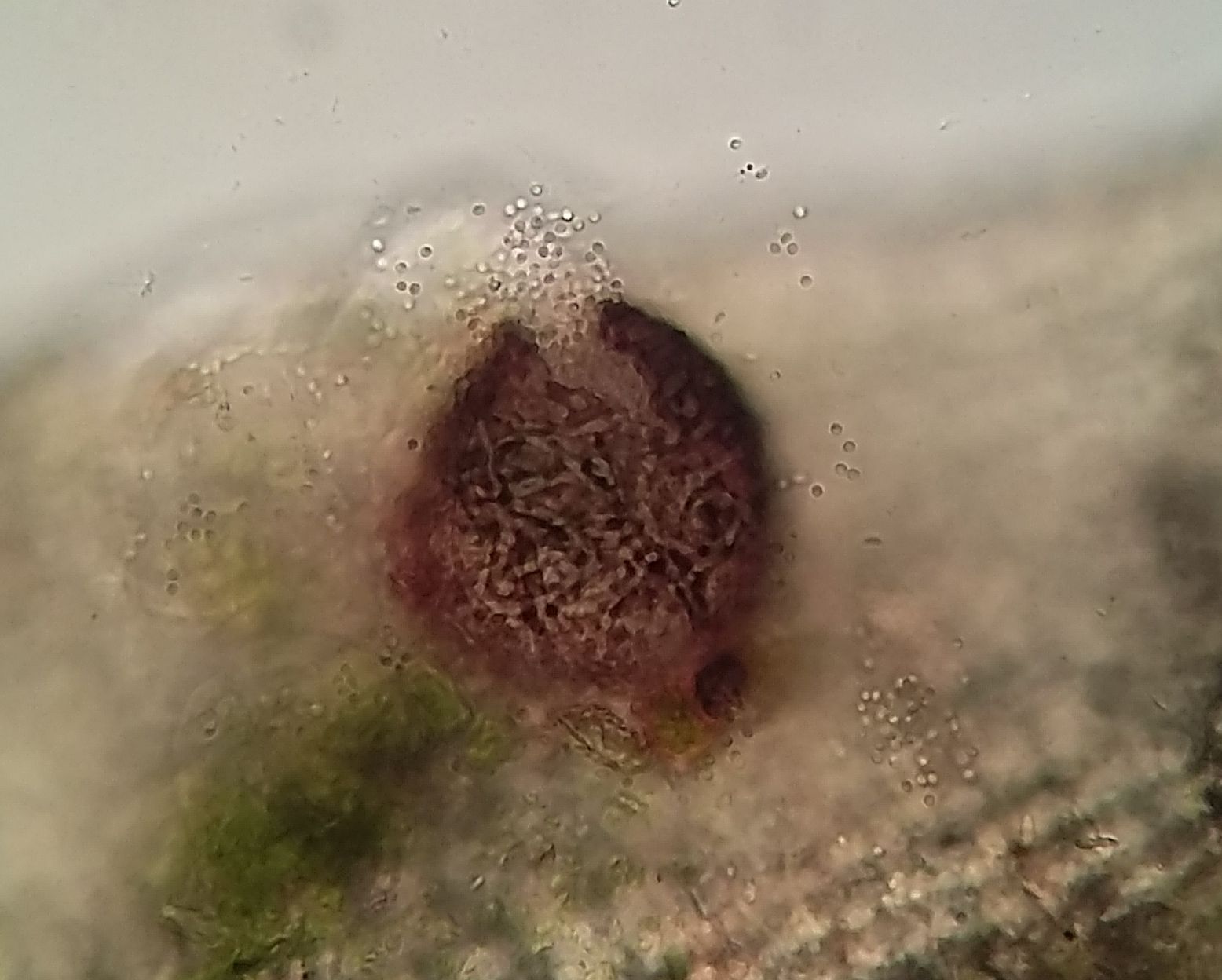 Phoma sp.1 – Bryophilous fungi