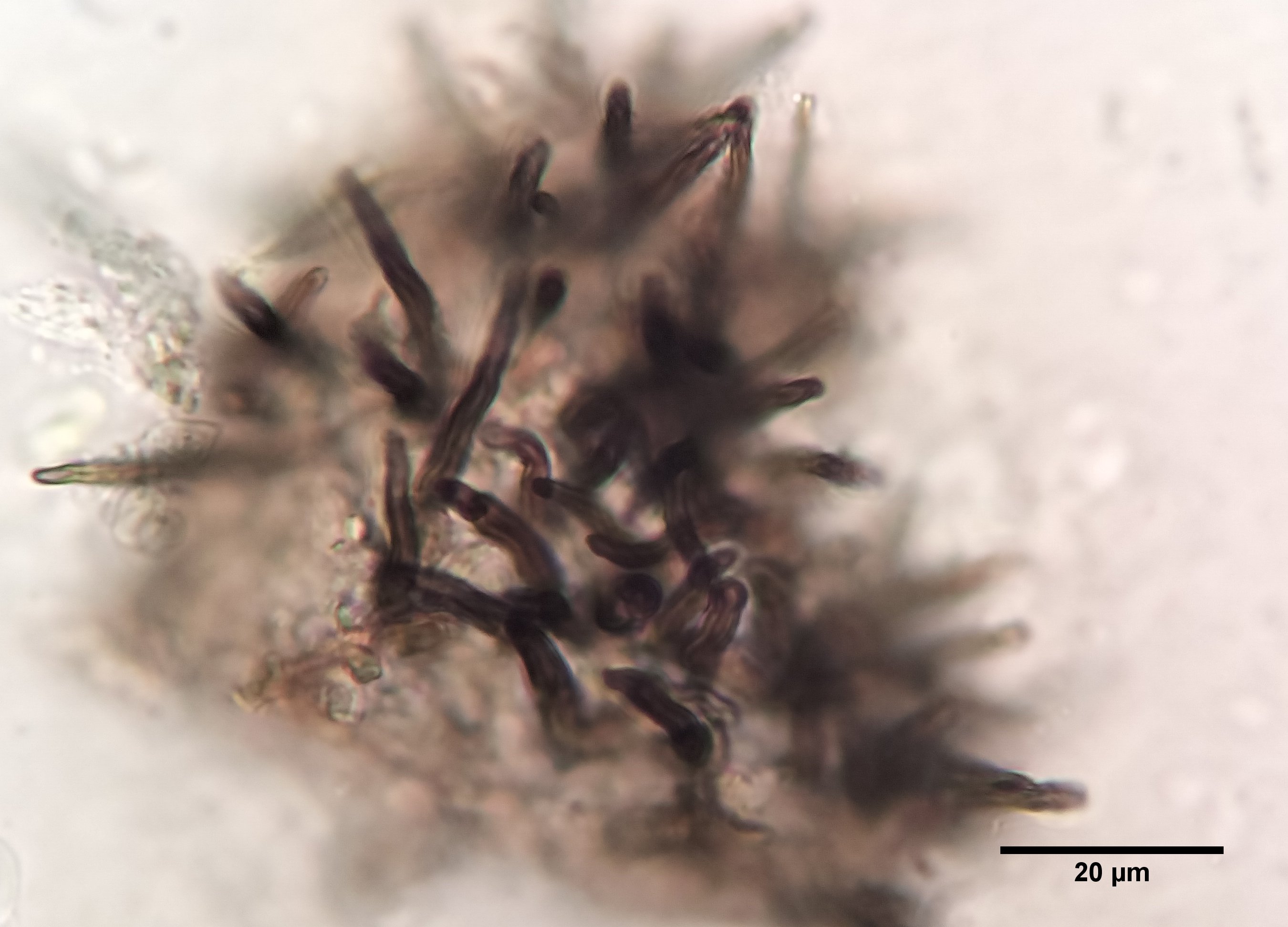 Epibryon hepaticicola – Bryophilous fungi