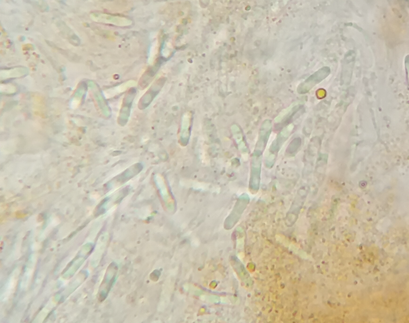 Bryocentria confusa – Bryophilous fungi